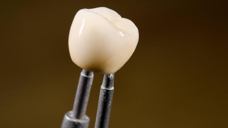 How Dental Crowns Save Damaged Teeth?