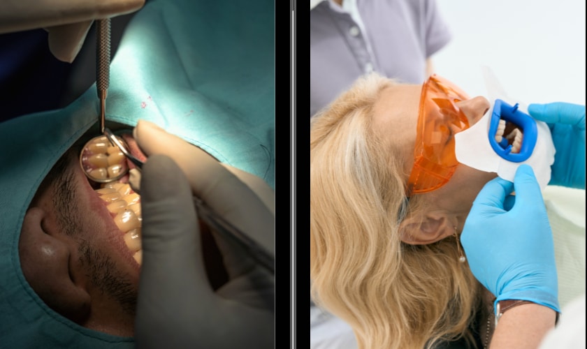 Root Canal vs. Tooth Extraction: Which Is the Better Option?